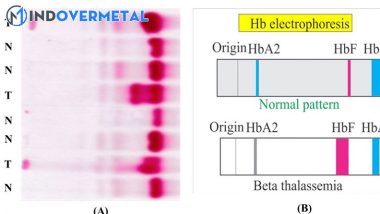 Sự khác biệt giữa HbA và HbF như thế nào? | mindovermetal
